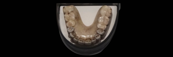 Claudius Ash: The Goldsmith Who Revolutionised Dentistry